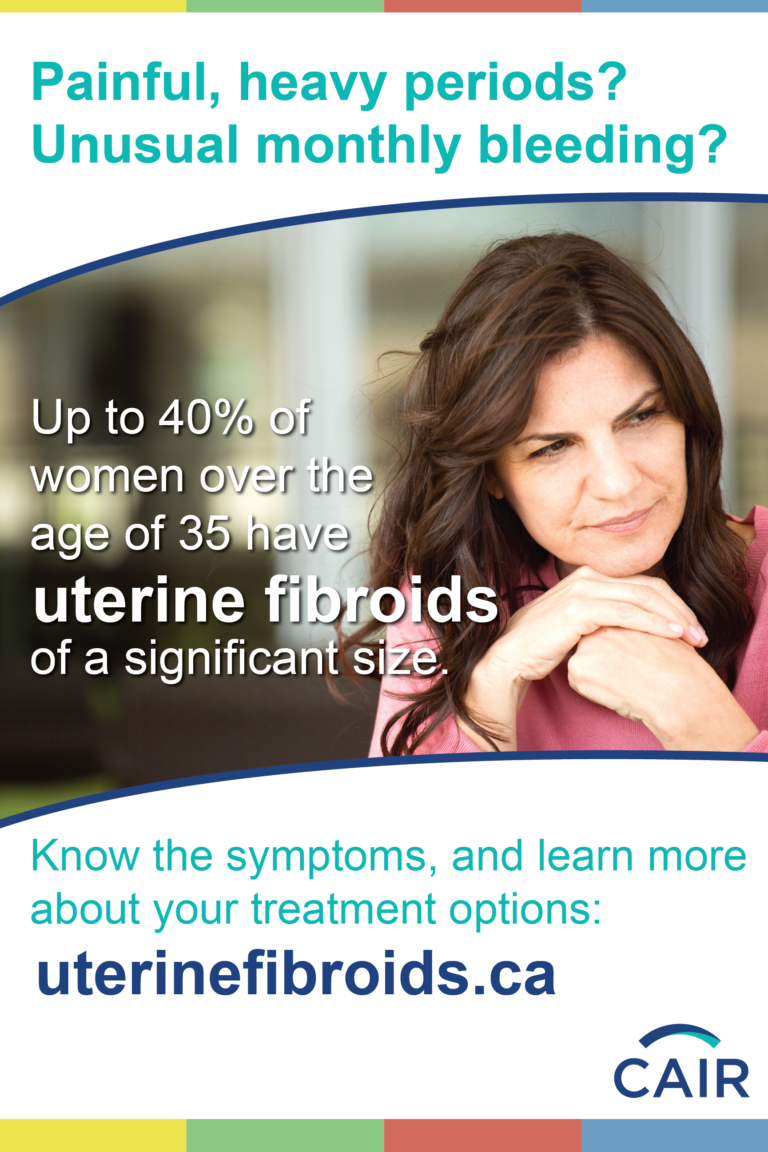 Uterine Fibroid Embolization - CAIR